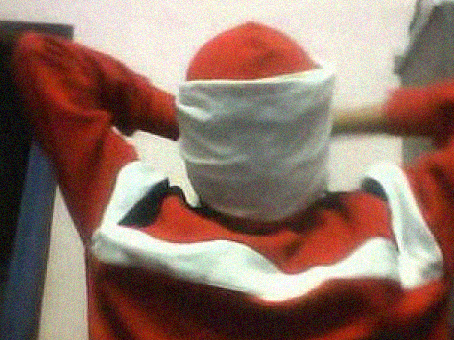 Mechanical Asphyxia in Forensic Medicine - SmarTeach